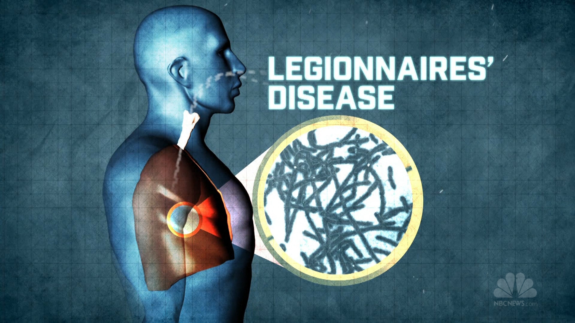 Spring Hot Tub Season Brings Safety Warning from Legionella Expert ...